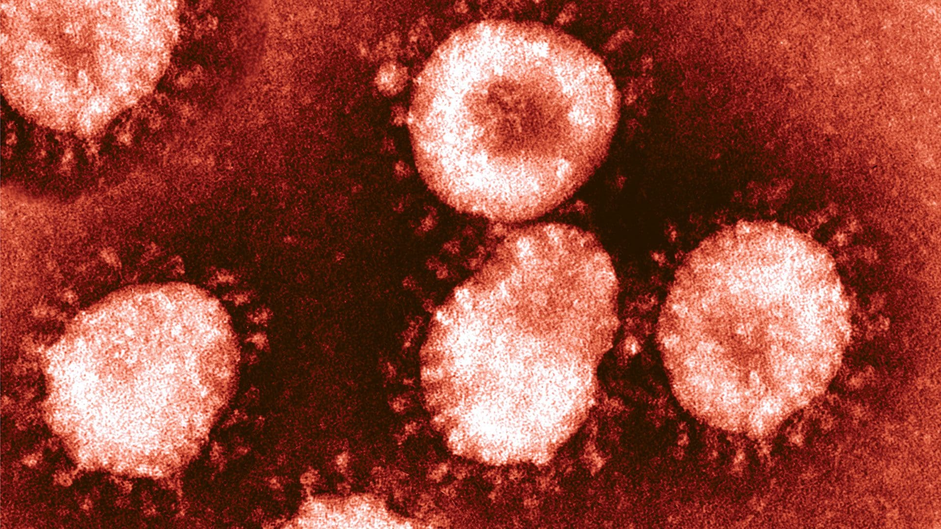 Coronavirus: News & Updates - BusinessWest
